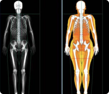 Best DEXA Scan in Boston, Massachusetts - Testing for Body Composition ...