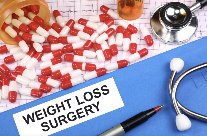 Weight Loss Surgery Options: Is It Right for You?
